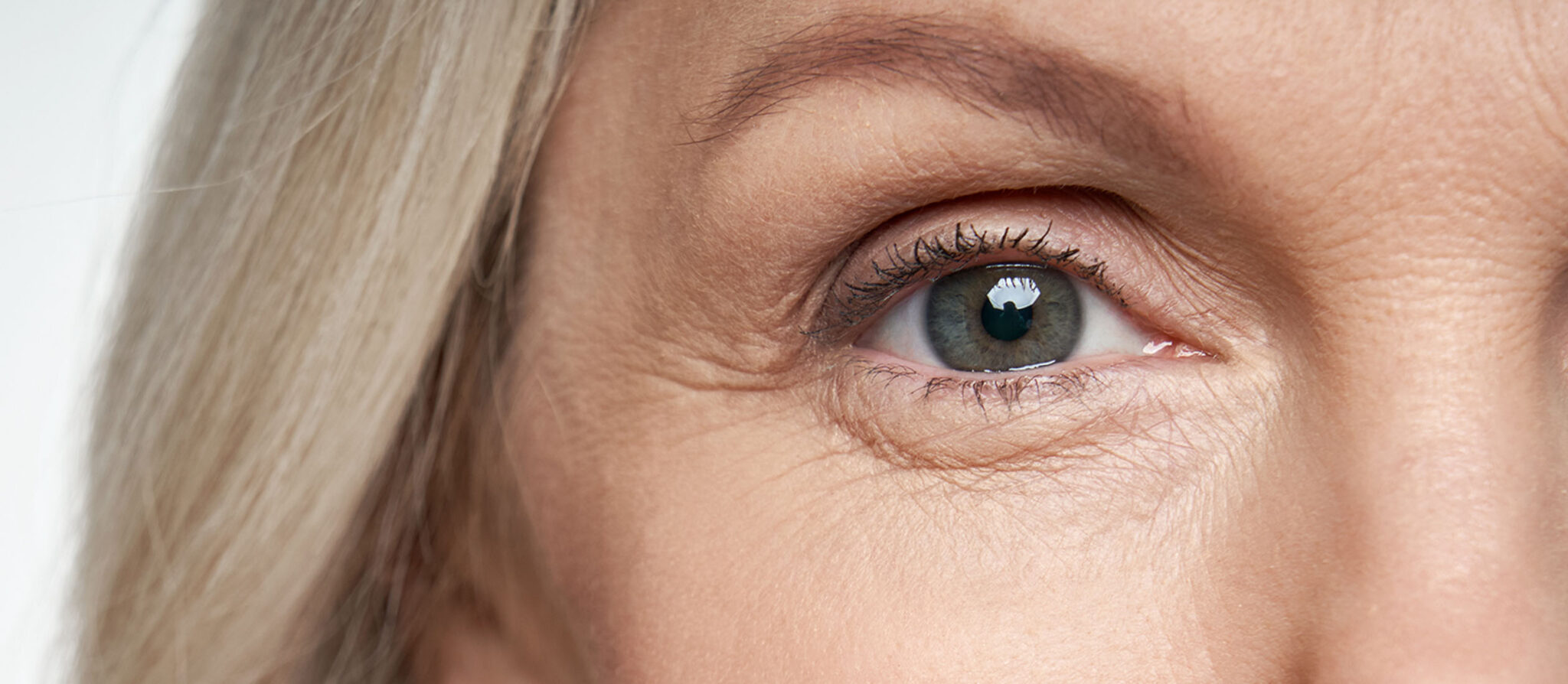 4 Best Non-Surgical Under Eye Solutions – Anti-Aging Tips